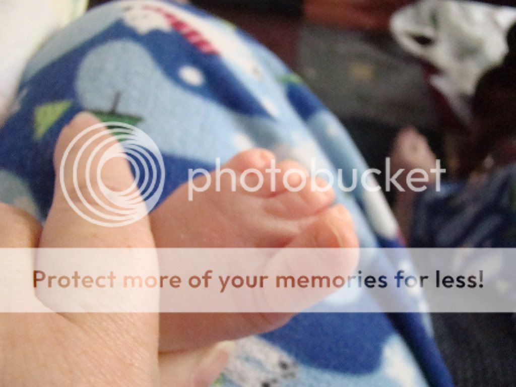 Webbed toes? | BabyCenter